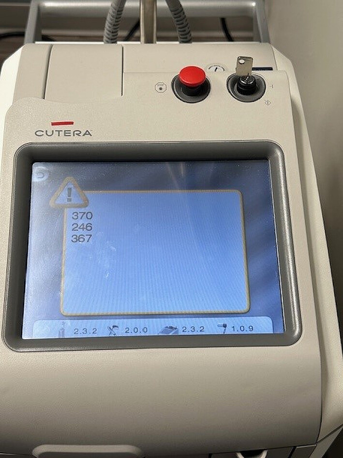 Cutera Excel HR - Hair Removal Laser