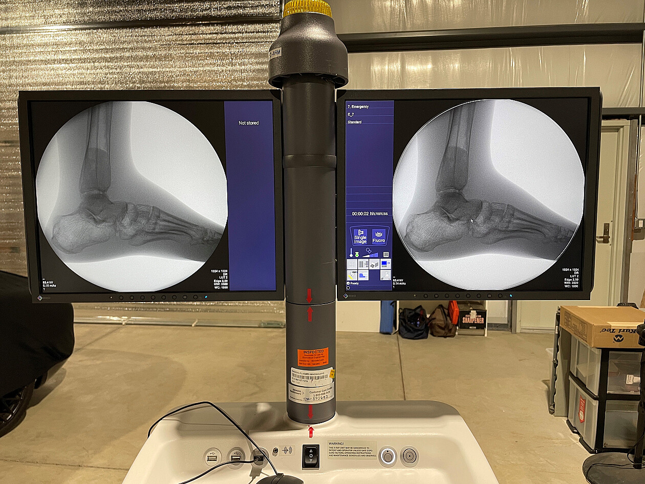 2016 Siemens Cios Connect ESP